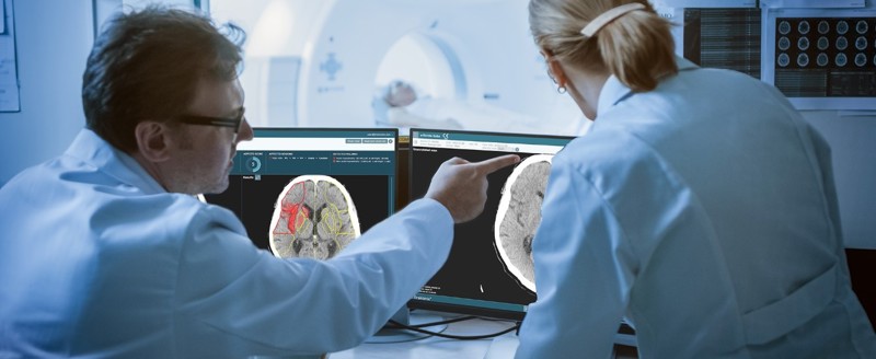 Medical AI and Stroke Care News | Brainomix
