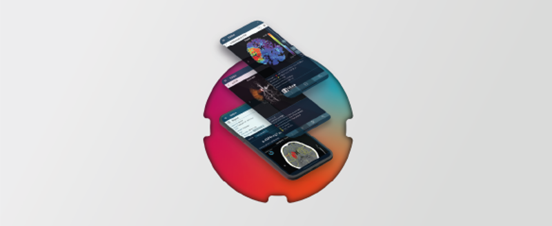 Medical AI and Stroke Care News | Brainomix