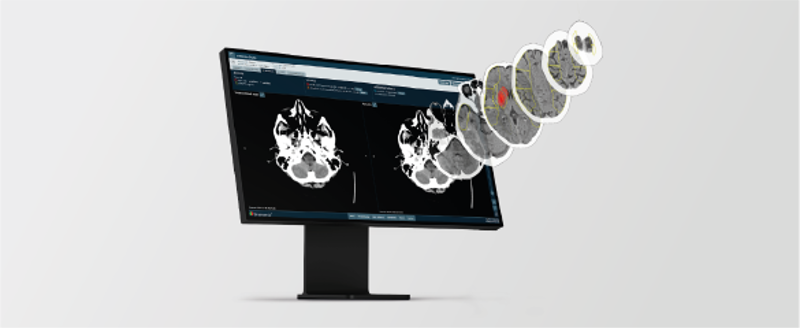 Brainomix | Resources